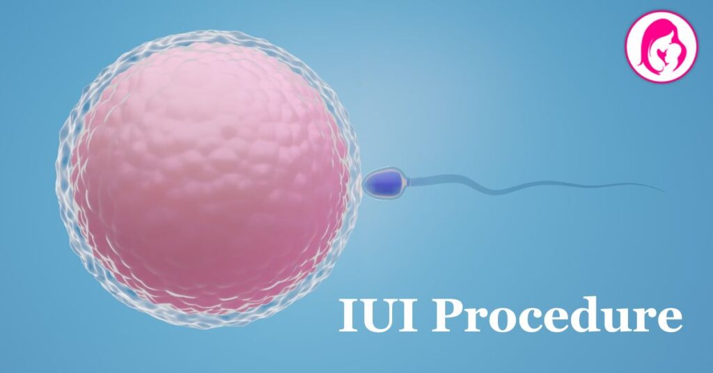 IUI Procedure